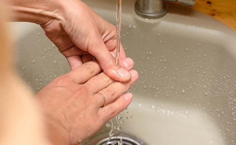 Burns — Know When to Go to the ER